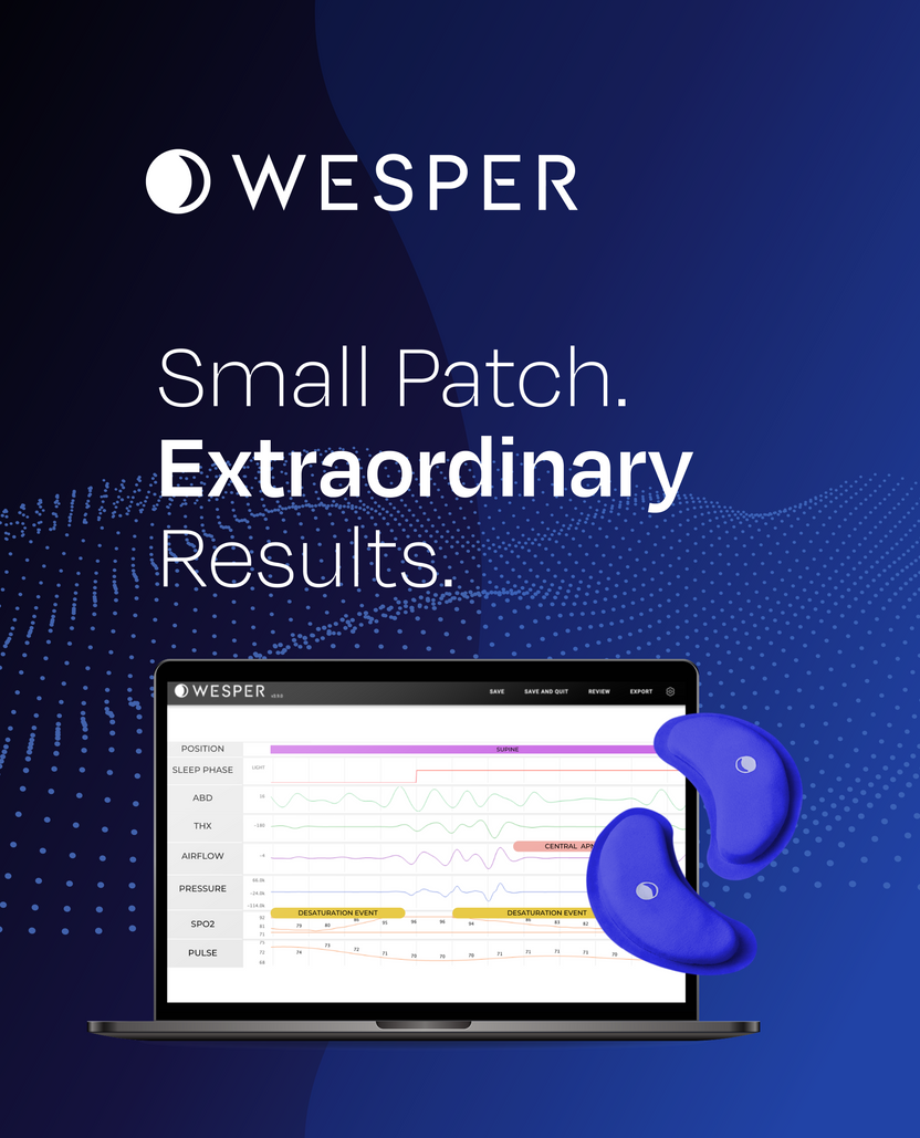 Introducing New Interpretation Page & Multi-Night Reports – Wesper